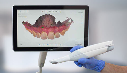 Intraoralscanner